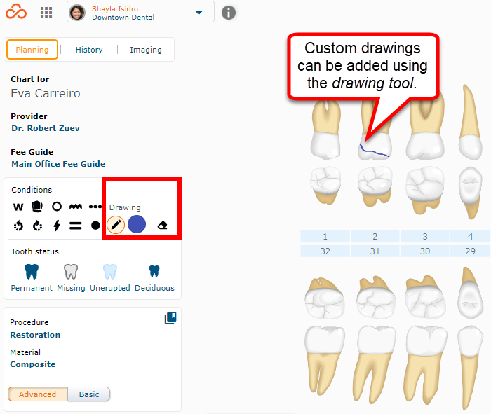 Charting Menu Overview – Curve Dental